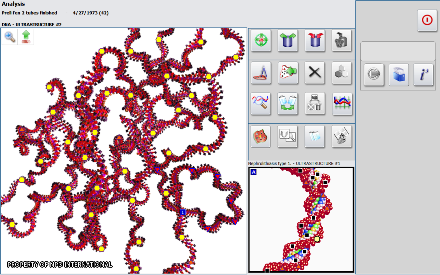 Kidney DNA - NPD International