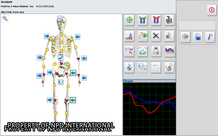 Skeleton User Interface - NPD International